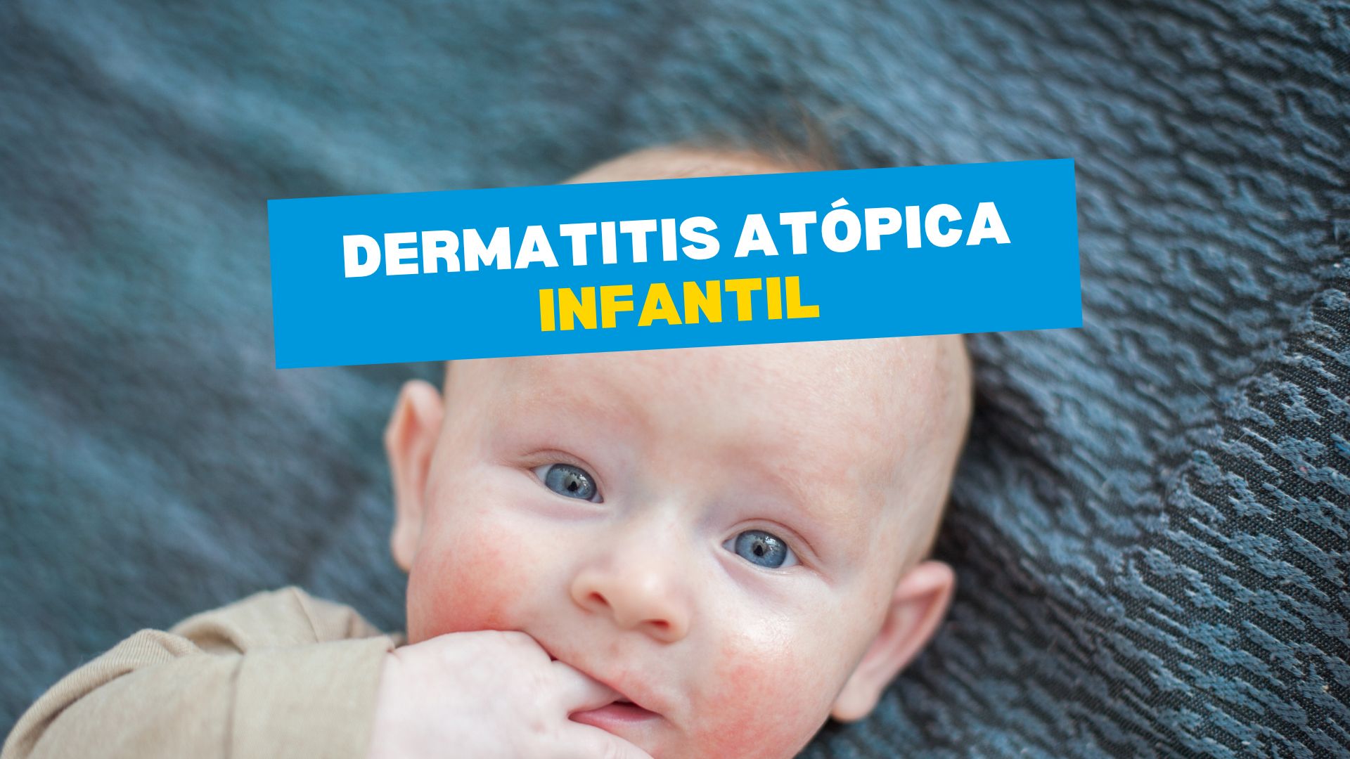 Lesiones de dermatitis atópica en bebés: causas y tratamientos. | Dr ...